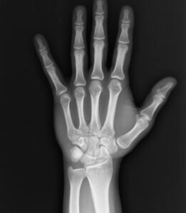 X-rays - Genesis Medical Group